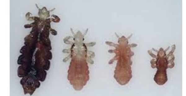 Hair Dye & Lice: Unraveling the Truth & Does It Work?